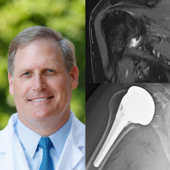 Catalyst OrthoScience Announces First Series of Procedures Using World ...