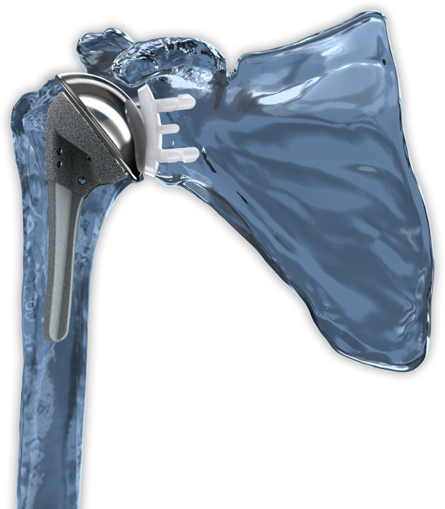 Healthcare Professionals - Catalyst OrthoScience