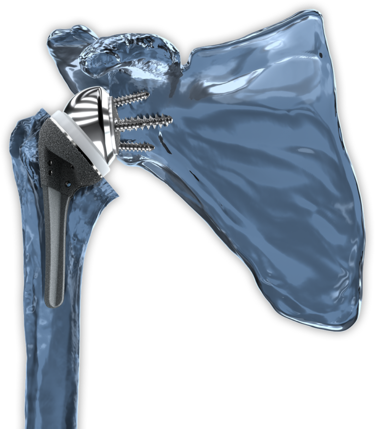 Healthcare Professionals - Catalyst OrthoScience