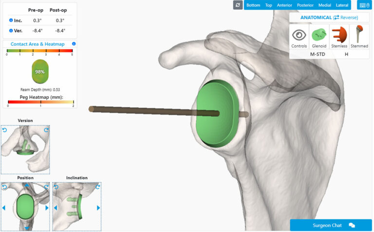 Healthcare Professionals - Catalyst OrthoScience