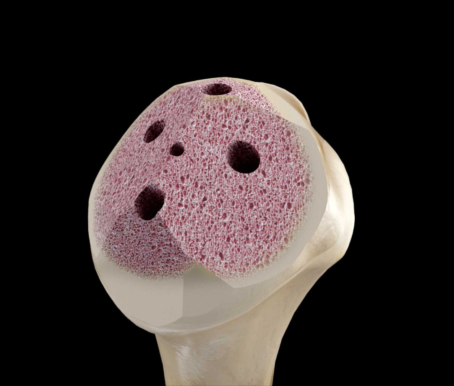 Home - Catalyst OrthoScience