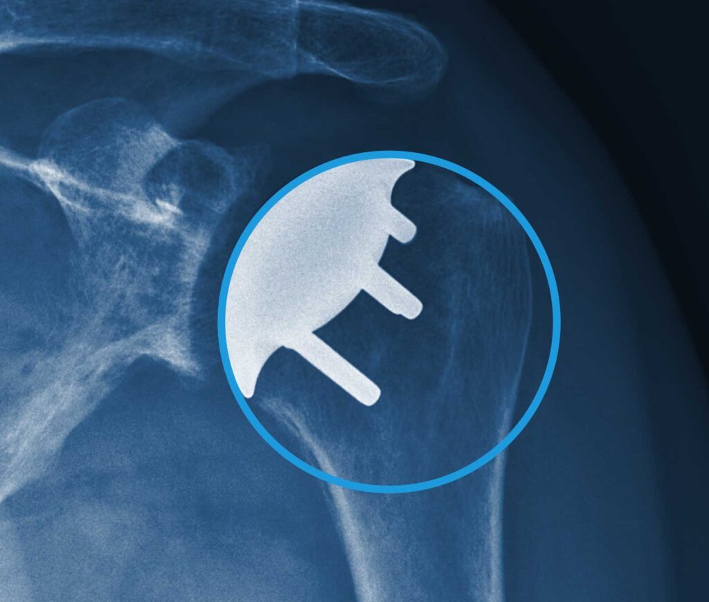 Home 3 - Catalyst OrthoScience