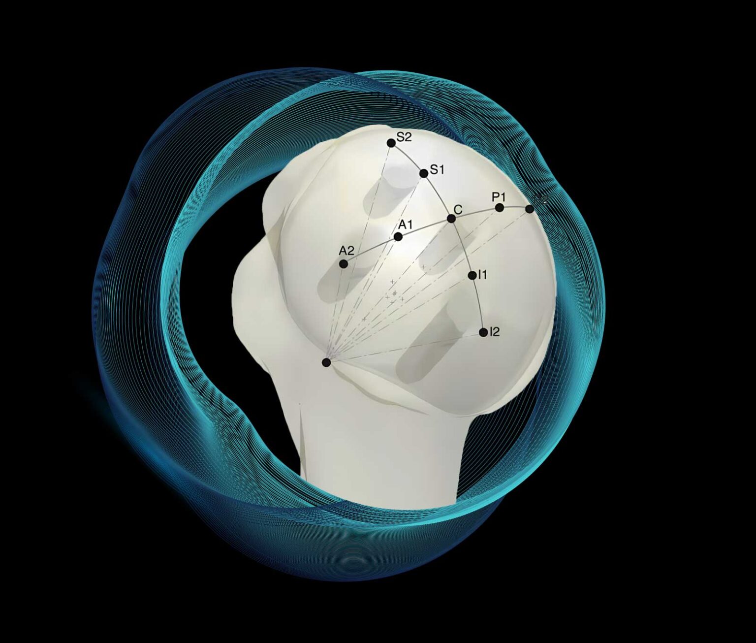 Home - Catalyst OrthoScience