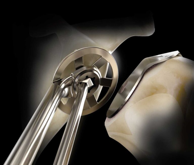 Home 3 - Catalyst OrthoScience