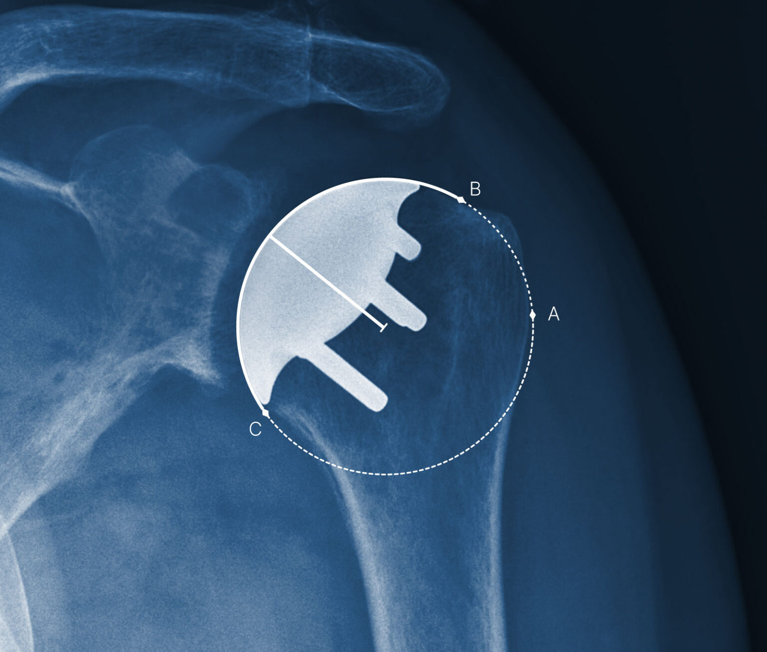 Home - Catalyst OrthoScience