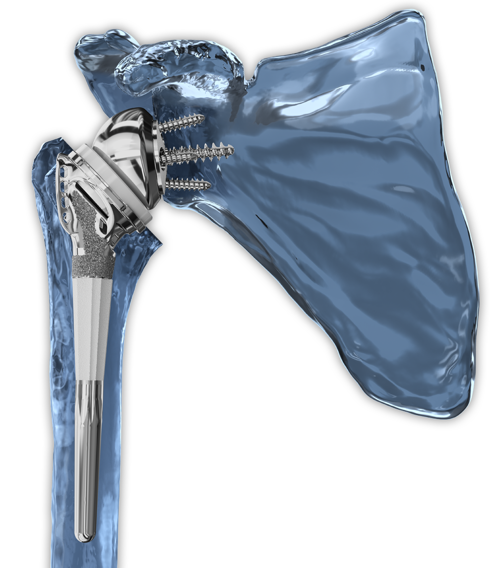 Healthcare Professionals - Catalyst OrthoScience